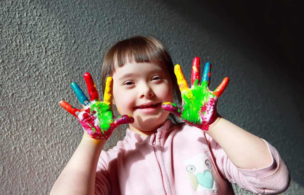 Understand on Down Syndrome for Infants | Sri Kota Medical