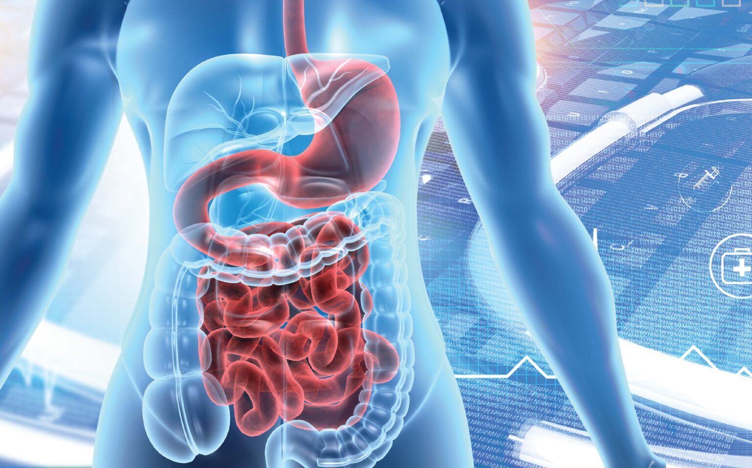 Preventing Colorectal Cancer Through "Intestinal" Planning